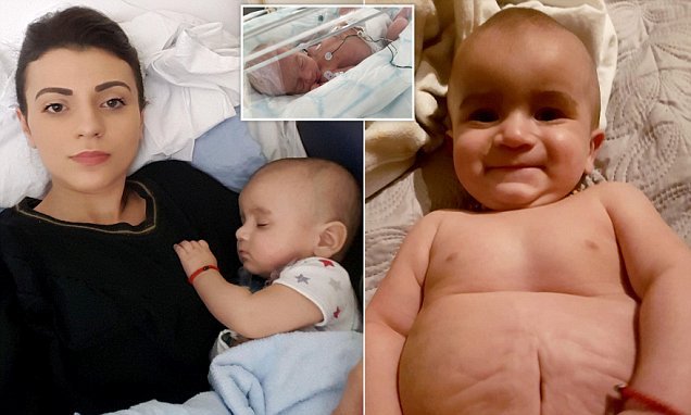 The toddler born without any stomach muscles - Health Worlds News